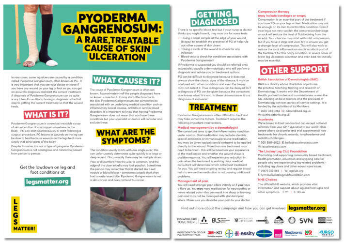 Pyoderma Gangrenosum Leg Ulcers A Rare Cause Of Leg Ulceration
